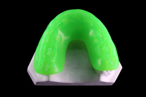 Cadmus Dental Lab | Other Products