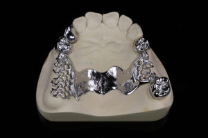 Cadmus Dental Lab | Dentures and Partials