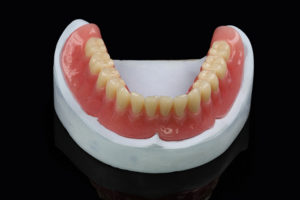 Cadmus Dental Lab | Dentures and Partials